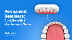 Permanent Retainers: Cost, Benefits & Maintenance Guide
