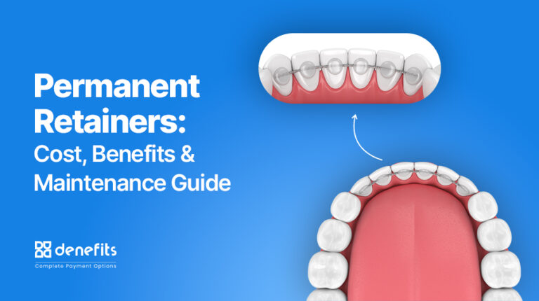 Permanent Retainers: Cost, Benefits & Maintenance Guide